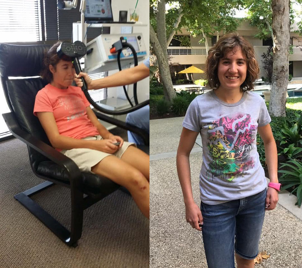 MeRT treatment for Autism in Newport Beach, California